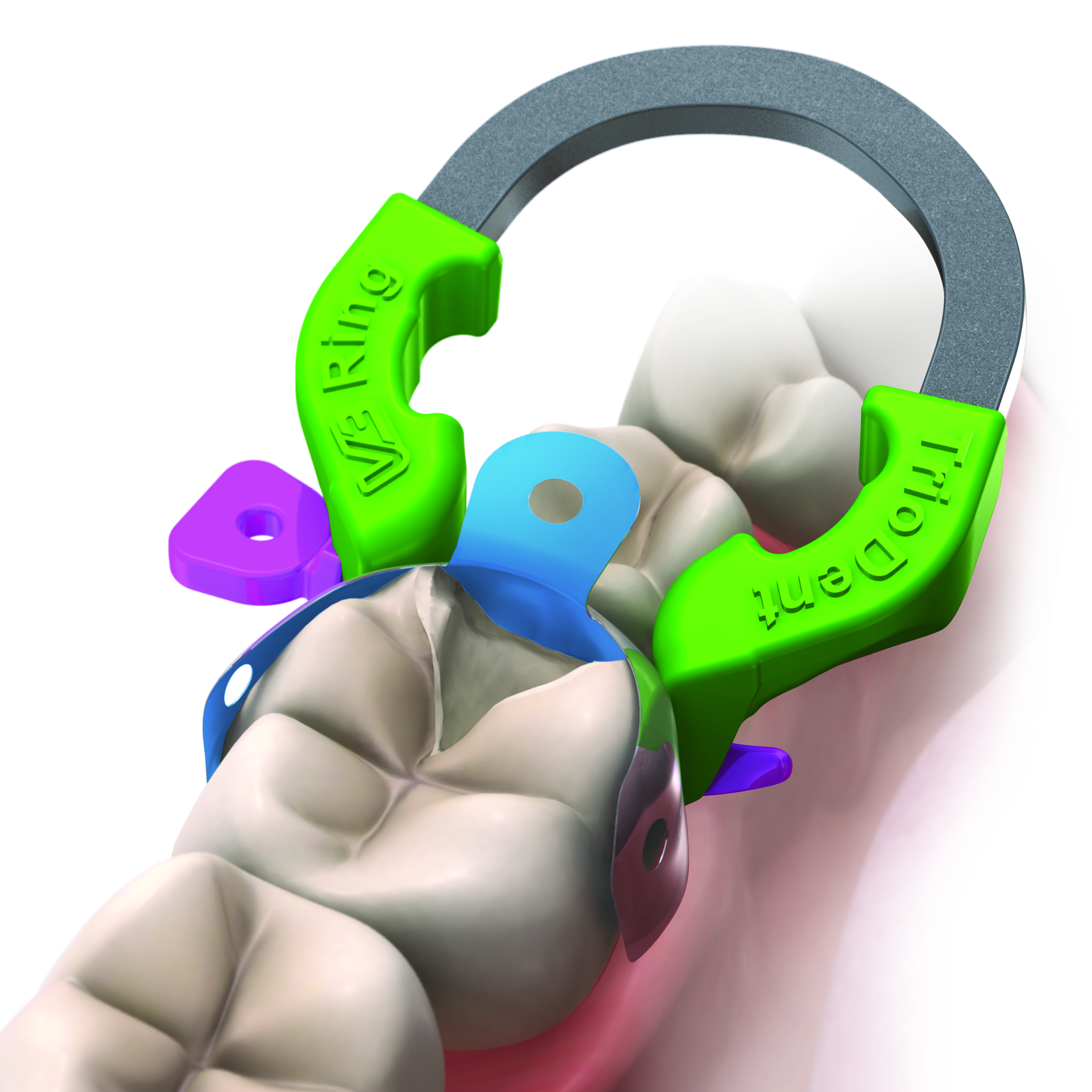 how-the-triodent-v3-ring-outperforms-the-competition
